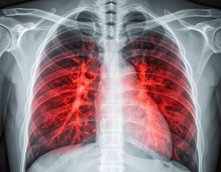 Chest Congestion: Causes, Symptoms & What You Can Do About It - Air Doctor